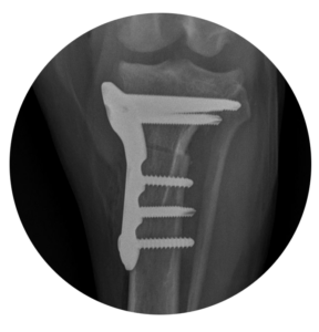 TPLO Plate - InVictos